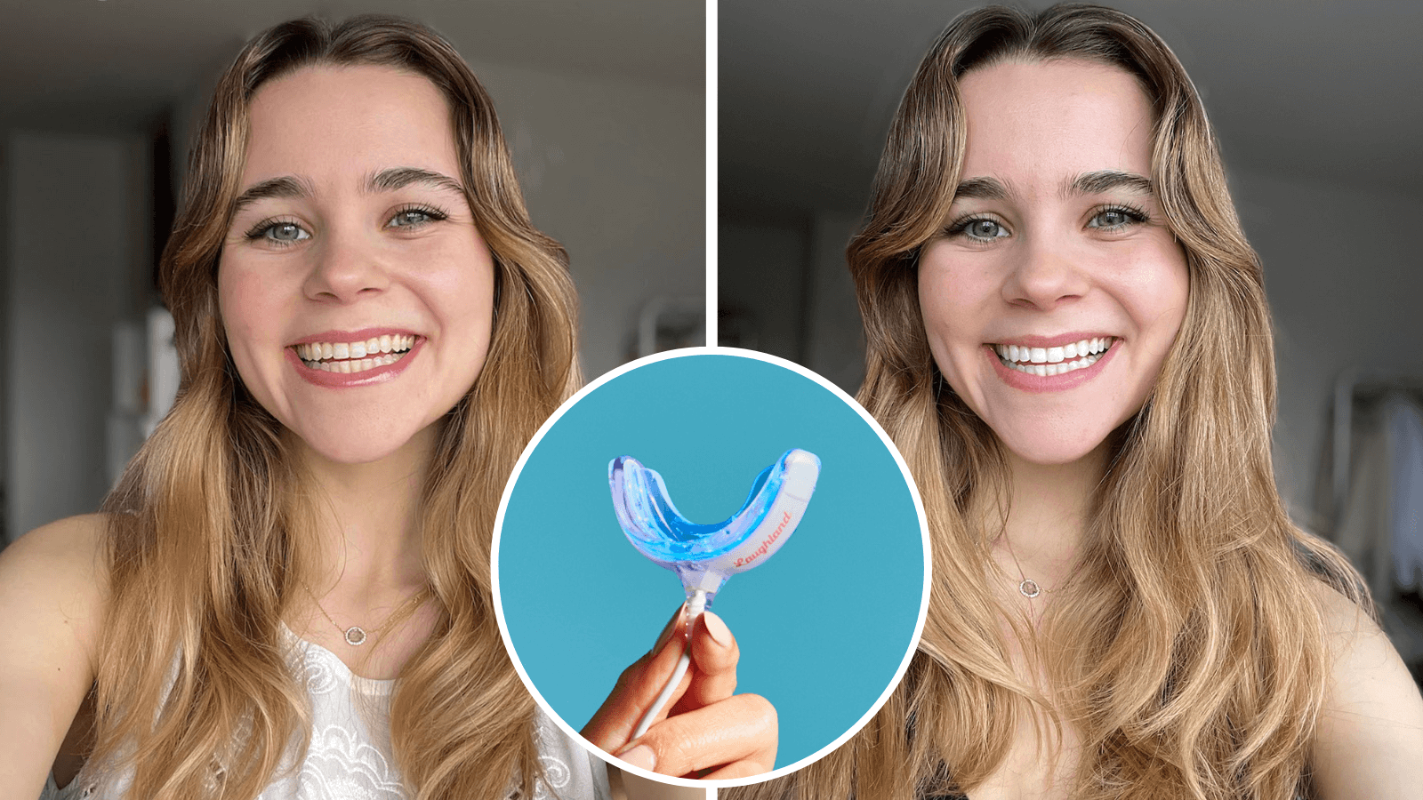 The Best At Home Teeth Whitening Kit | Laughland Review
